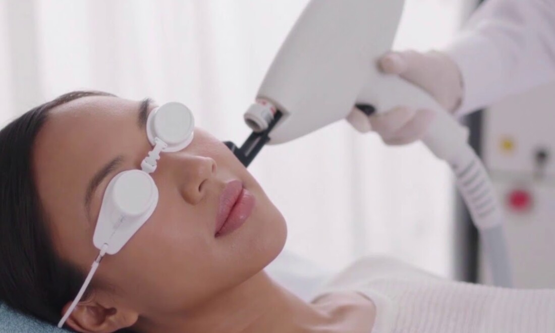 Alma Introduces PixelPeel